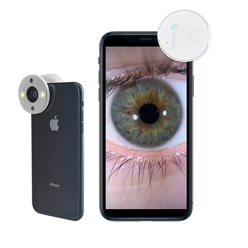 QuikVue Smartphone Eye Imaging | OcuLab